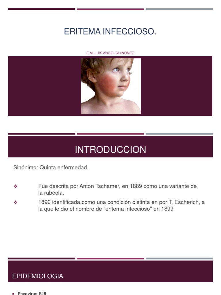 Eritema Infeccioso | PDF | Virología | Rtt