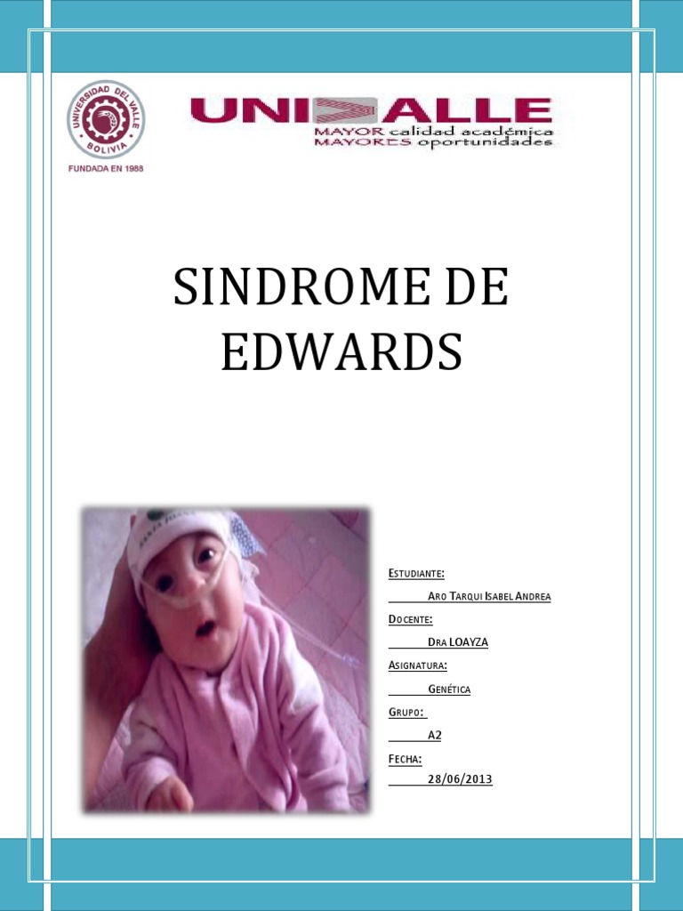 Síndrome de Edwards: Diagnóstico y Tratamiento | PDF | El embarazo ...