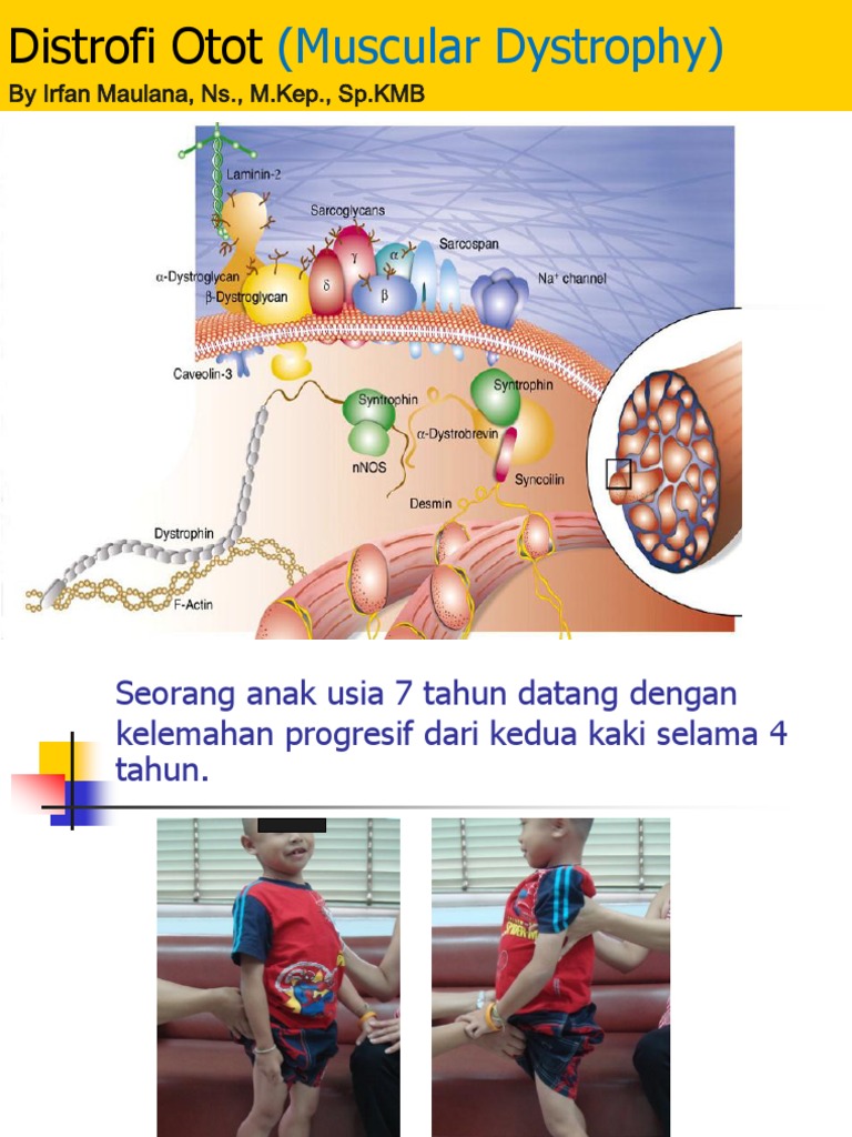 Distrofi Otot: Definisi dan Klasifikasi | PDF | Distrofi Otot | Bahu