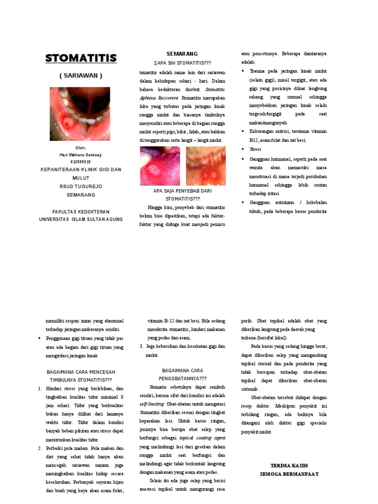 Panduan Lengkap Stomatitis dan Sariawan | PDF | Kesehatan Holistik