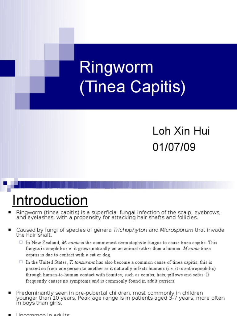 Ringworm (Tinea Capitis) | PDF | Clinical Medicine | Diseases And Disorders
