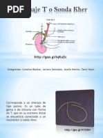Drenaje Biliar: Sonda T y Cuidados | PDF | Cirugía | Especialidades Medicas