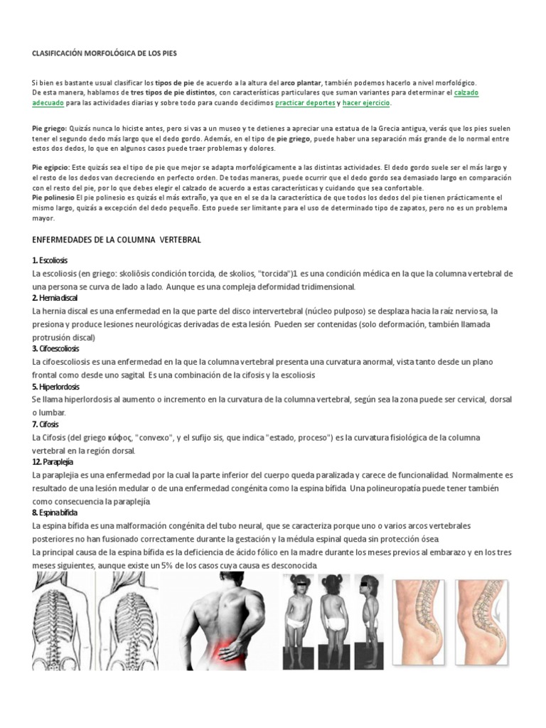 Clasificación Morfológica de Los Pies | PDF | Pie | Escoliosis