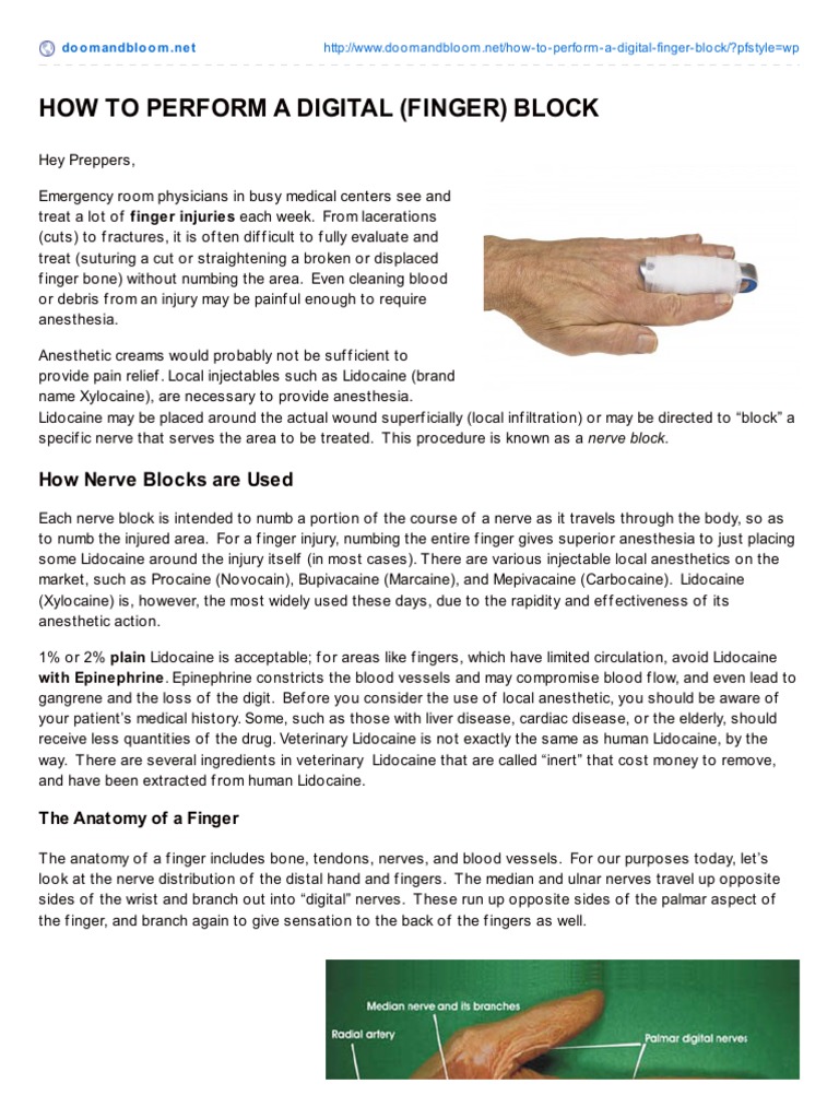 doomandbloom.net-HOW_TO_PERFORM_A_DIGITAL_FINGER_BLOCK.pdf | Anesthesia ...