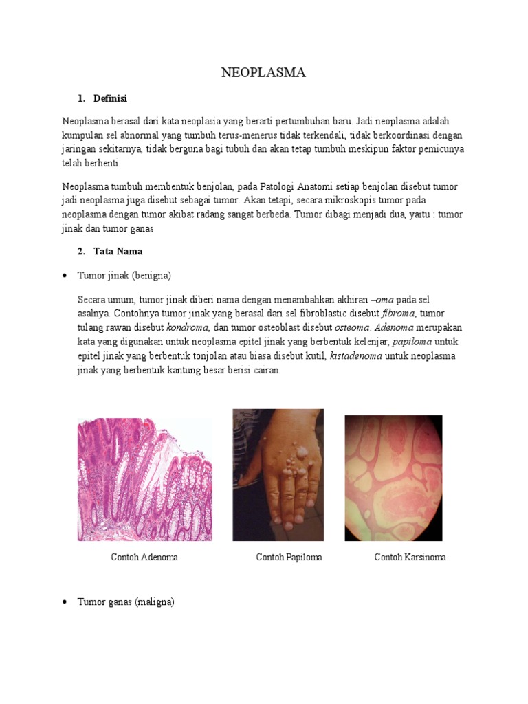 NEOPLASMA (Definisi, Tata Nama, Karakteristik, Perbedaan Tumor Jinak ...