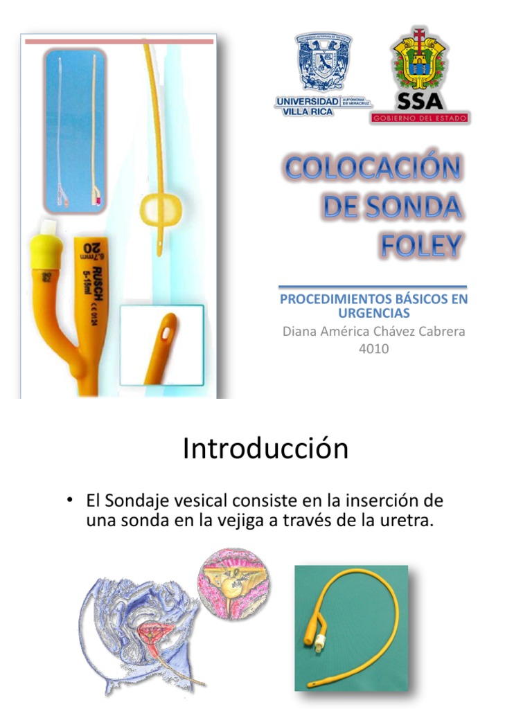 Colocación de Sonda Foley | Urinary Bladder | Urology