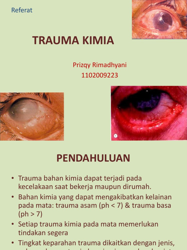 Trauma Kimia Mata - Perumperindo.co.id