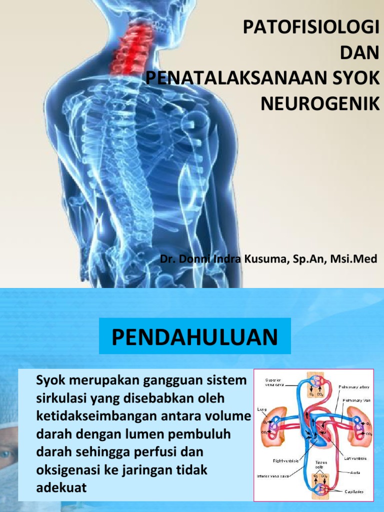 Syok Neurogenik DR - Donni | PDF