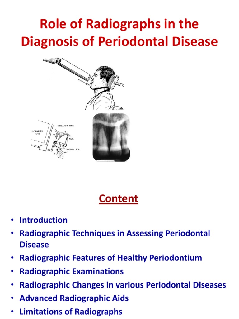 Role of Radiographs in Pdl. Disease | PDF | Radiography | Dental Anatomy