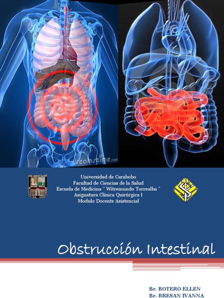 Clinica Quirurgica I. Obstruccion Intestinal Final | Digestión | Diarrea