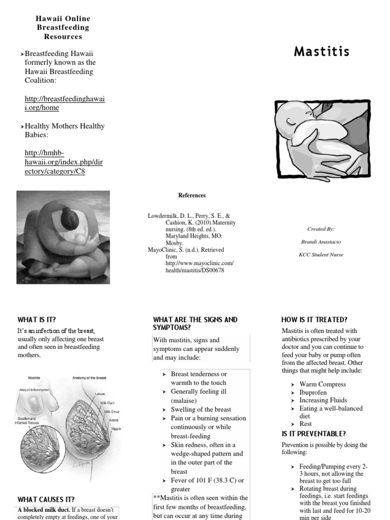 Mastitis Teaching Plan | PDF