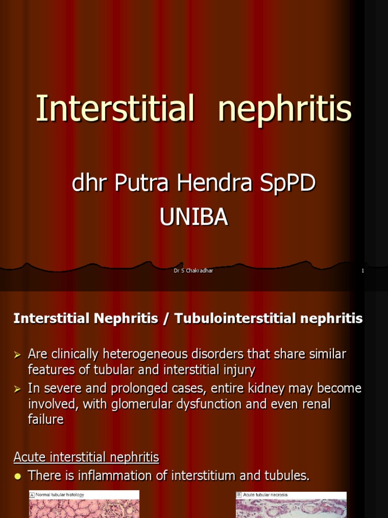 Understanding Interstitial Nephritis | PDF