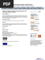 Motion Sensitivity Test | PDF | Vertigo | Clinical Medicine