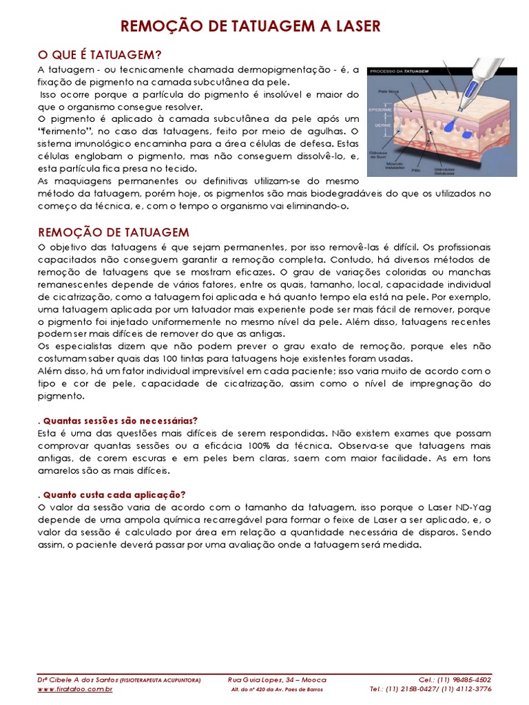Manual Remocao Tatuagem Download Grátis Pdf Tatuagem Pigmento