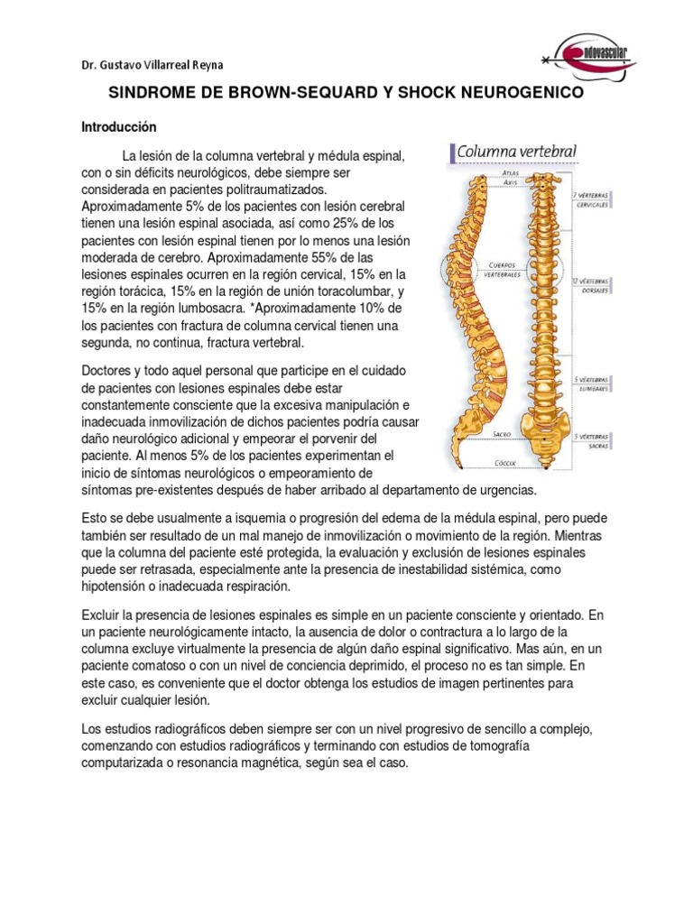 Sindrome Brown Sequard y Shock Neurogenico | Médula espinal | Choque ...