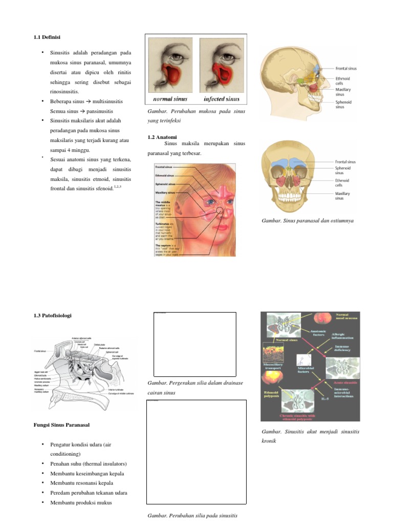 Leaflet Asuhan Keperawatan Sinusitis | PDF