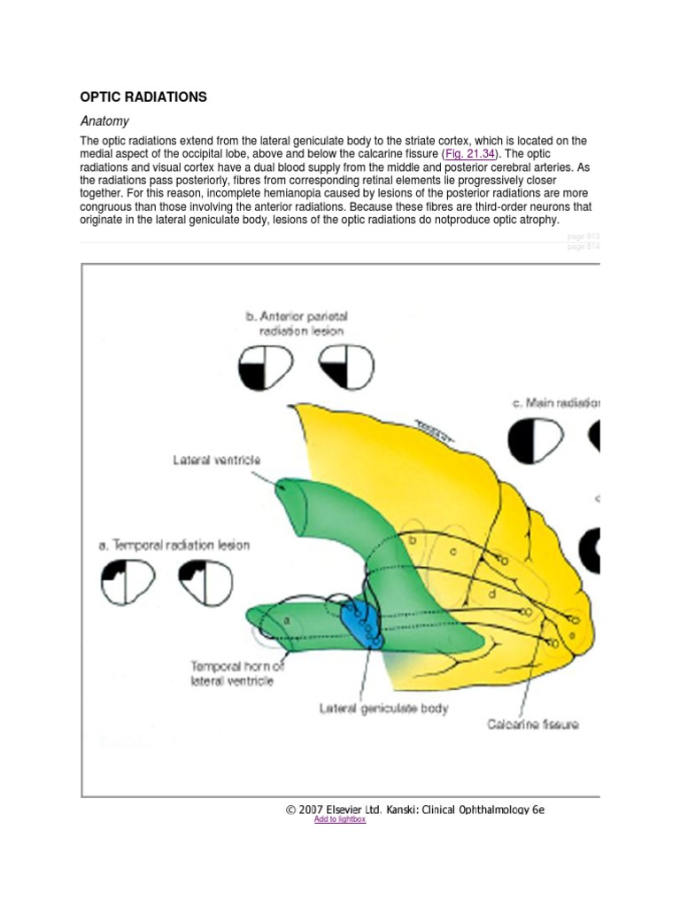 5 Optic Radiations | Parietal Lobe | Occipital Lobe