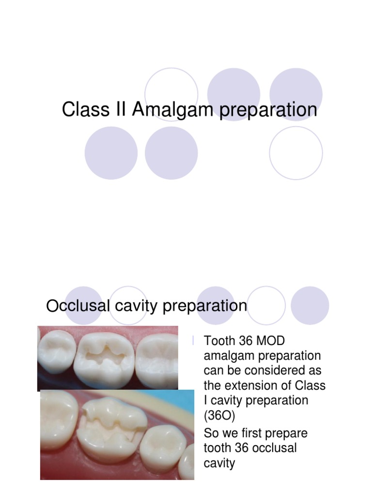 Class II Amalgam Preparation | PDF | Tooth Enamel | Tooth