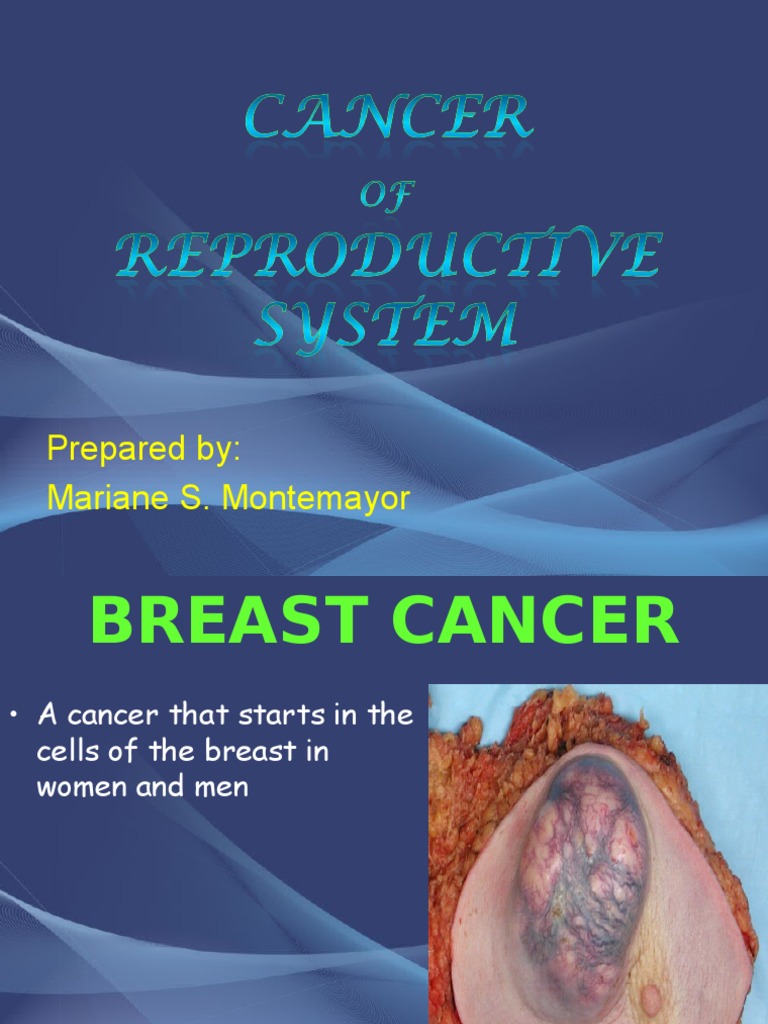 Cancer of Reproductive System | PDF | Cervical Cancer | Breast Cancer