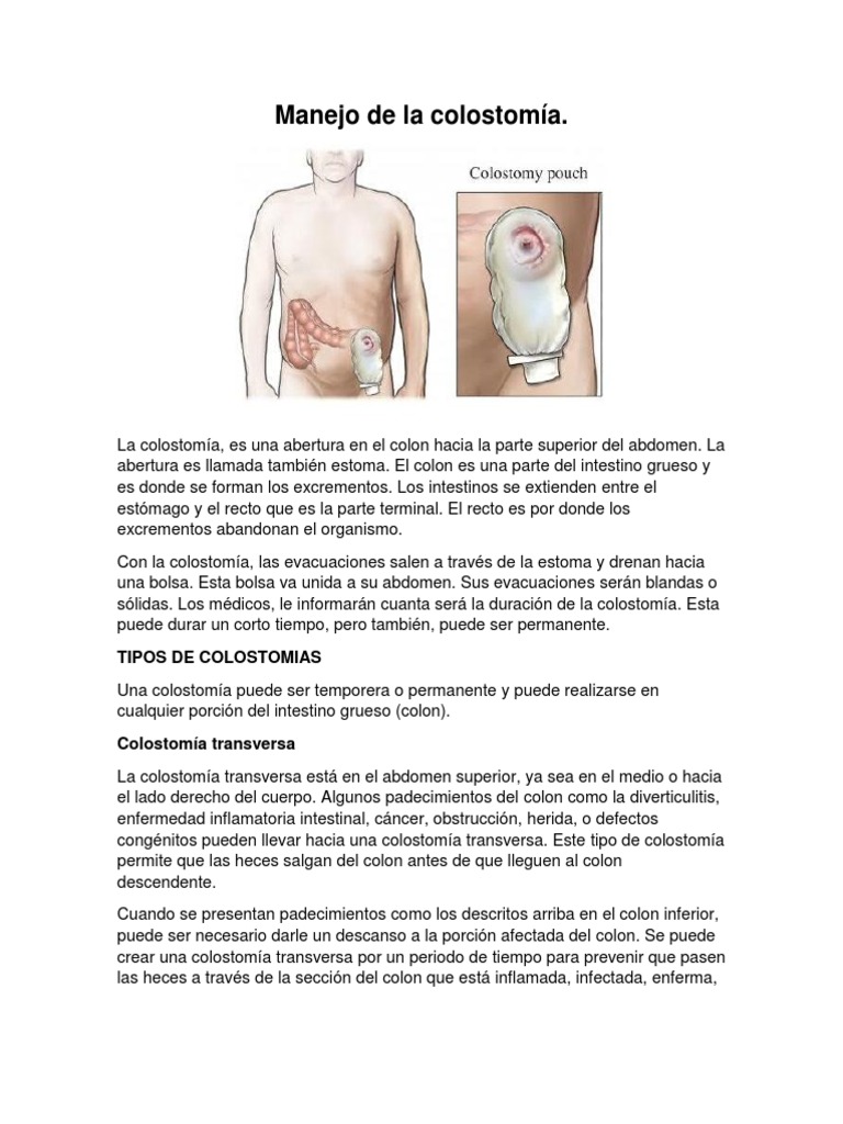 La Colostomía | PDF | Intestino grueso | Heces