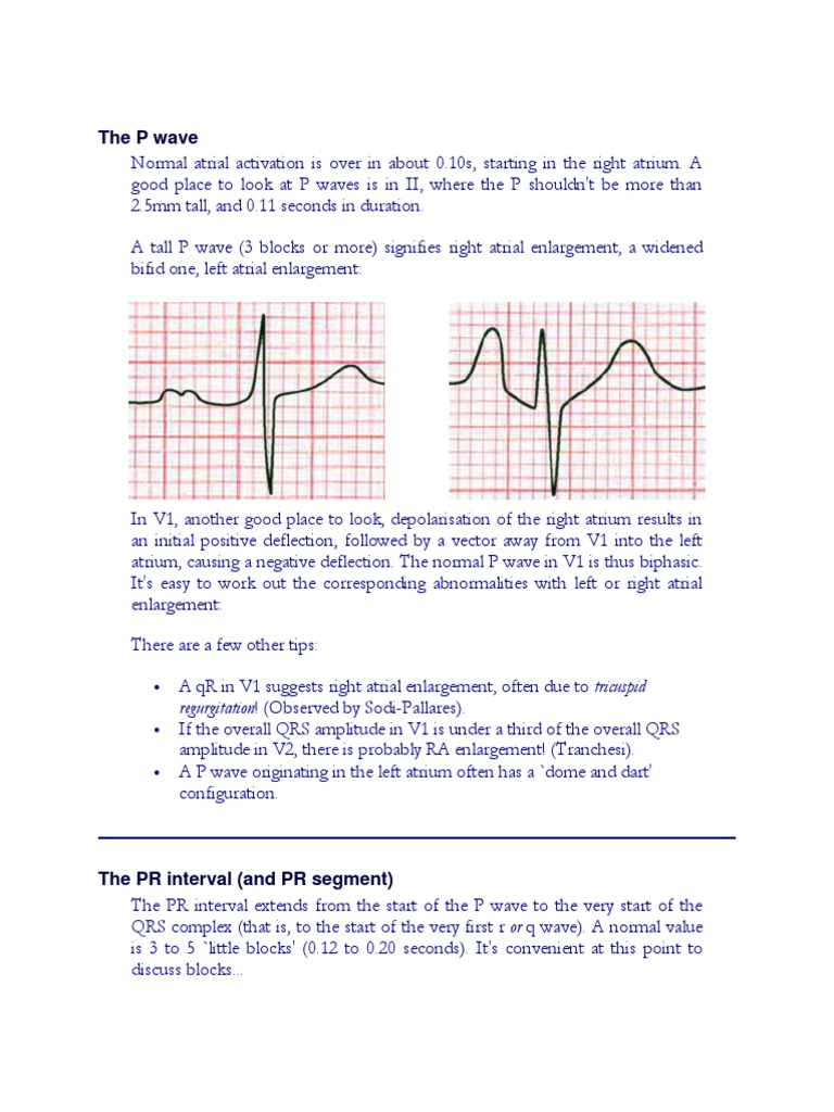 The P wave | Electrocardiography | Myocardial Infarction