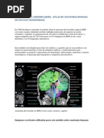 Irrigación Cerebral: Anatomía Detallada | PDF | Cerebelo | Cerebro