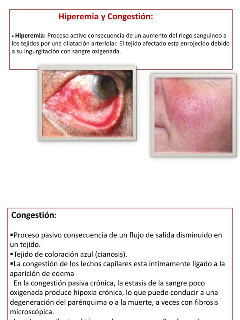 Hiperemia y Congestión2 | Plaqueta | Coagulación | Prueba gratuita de ...