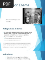 Procedimiento de Esofagograma con Bario | PDF | Estómago | Enfermedades ...