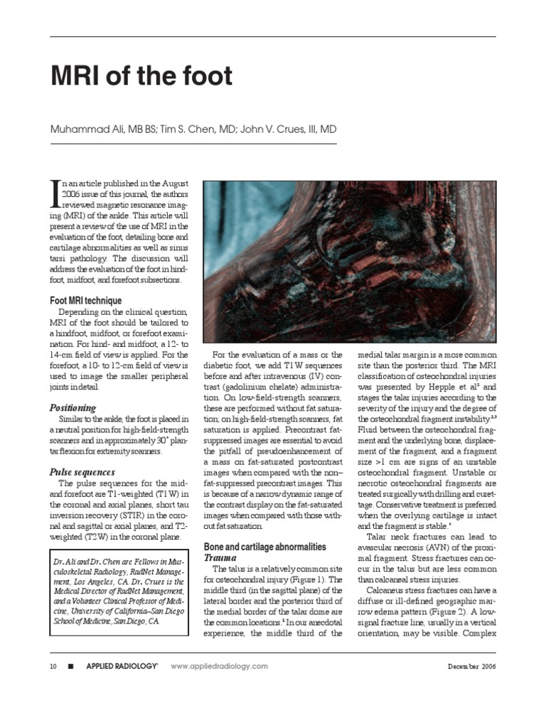MRI of The Foot: Muhammad Ali, MB BS Tim S. Chen, MD John V. Crues, III ...
