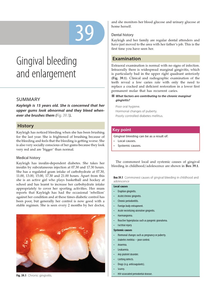 Gingival Bleeding and Enlargement | PDF