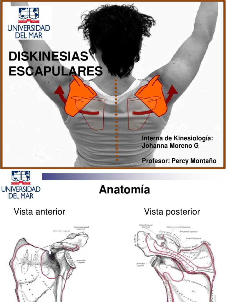 DISKINESCIAS ESCAPULARES
