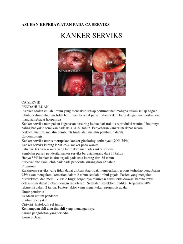 Asuhan Keperawatan Pada CA Serviks | PDF
