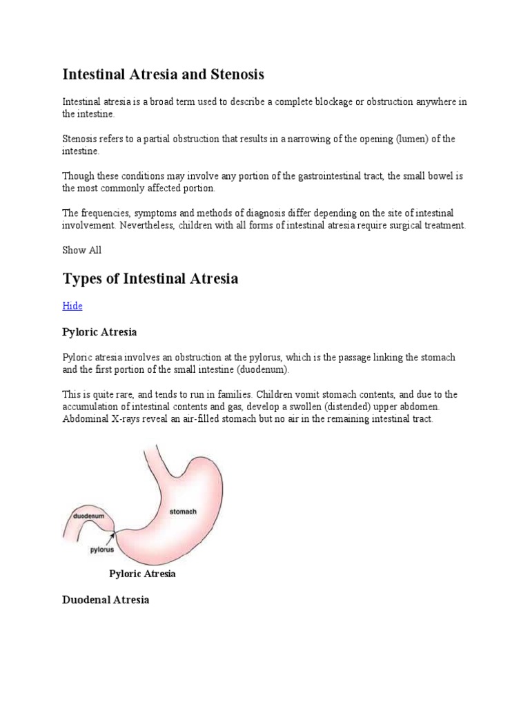 Intestinal Atresia and Stenosis | PDF | Gastrointestinal Tract | Stomach