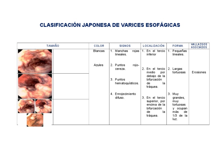 Clasificación Japonesa de Varices Esofágicas | PDF