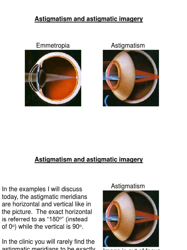 Astigmatism and Astigmatic Imagery | PDF | Eye | Senses