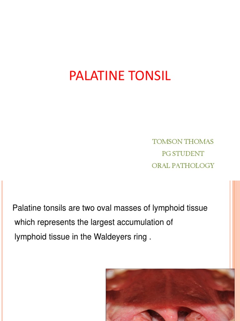 Palatine Tonsil | PDF | Lymphatic System | Tongue