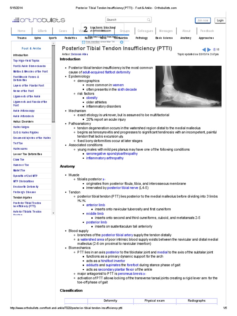 Posterior Tibial Tendon Insufficiency (PTTI) - Foot & Ankle ...