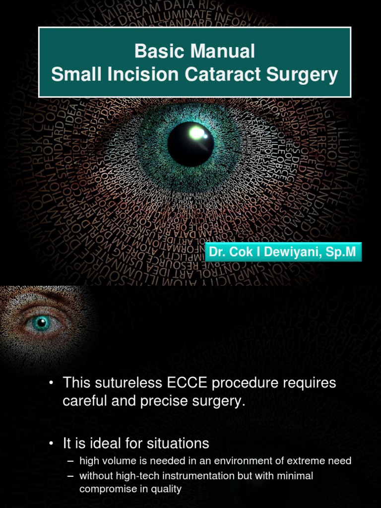 Basic Manual Small Incision Cataract Surgery: Dr. Cok I Dewiyani, SP.M ...