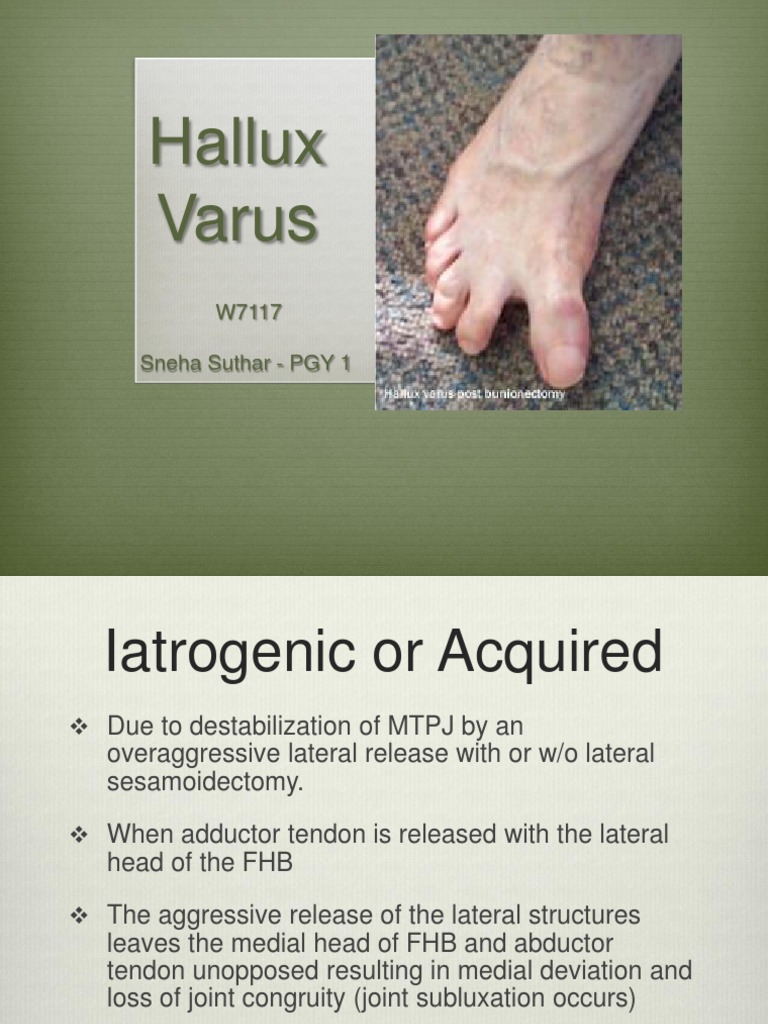 Hallux Varus | PDF | Toe | Anatomical Terms Of Motion