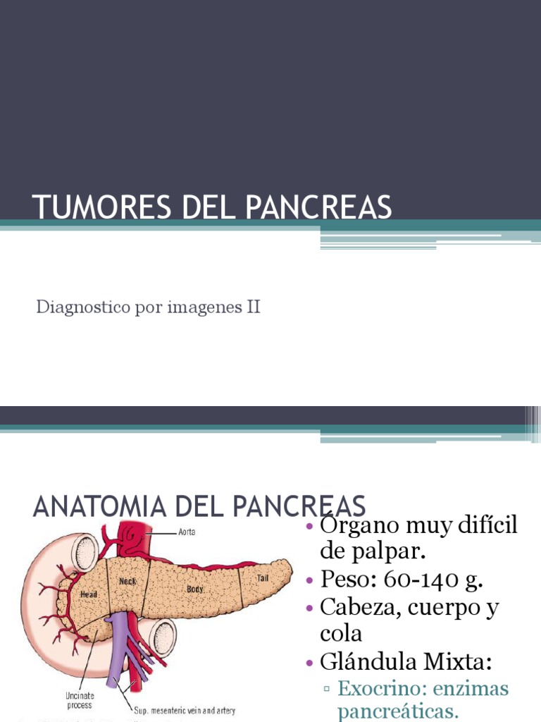 tumores pancreaticos | Páncreas | Gastroenterología