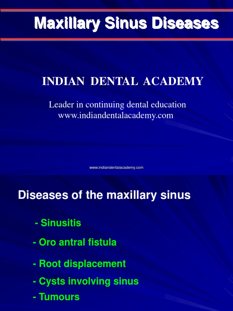 Maxillary Sinus (NXPowerLite) .PPT / Orthodontic Courses by Indian ...