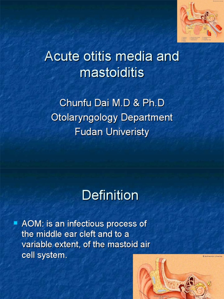 Acute Otitis Media and Mastoiditis | PDF