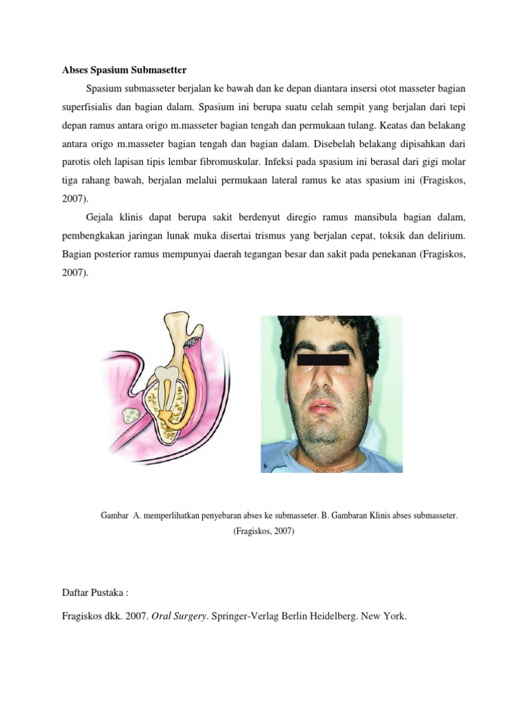 Abses Spasium Submasetter | PDF | Kajian Bahasa Asing