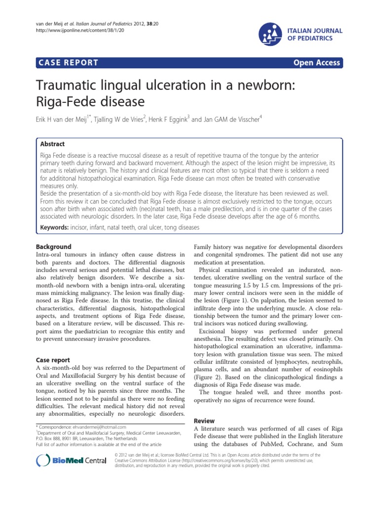 Riga-fede Traumatic Lingual | Biopsy | Medical Diagnosis