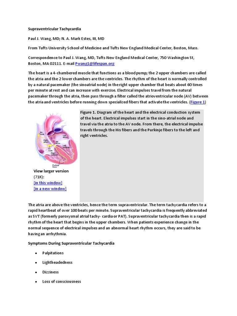 Supraventricular Tachycardia | PDF | Cardiac Arrhythmia | Electrophysiology