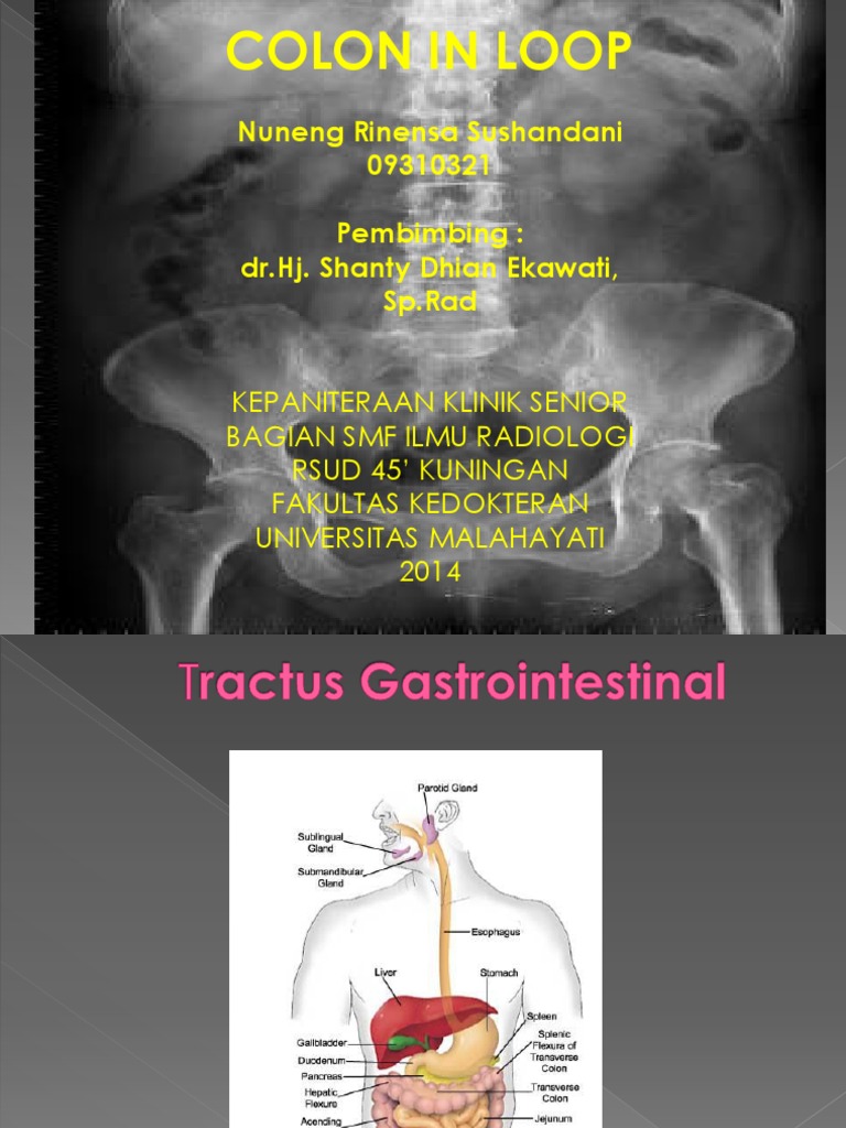 Colon in Loop | PDF | Sains & Matematika
