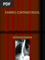 Exames Contrastados: Esofagografia Detalhada | PDF | Vômito | Esôfago