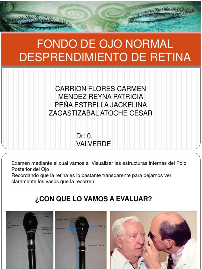 Fondo de Ojo Normal Seminario | PDF | Ojo humano | Percepción visual