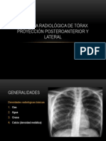 INTERPRETACION DE RX TORAX AP, PA Y LATERAL | PDF | Pulmón | Tórax ...