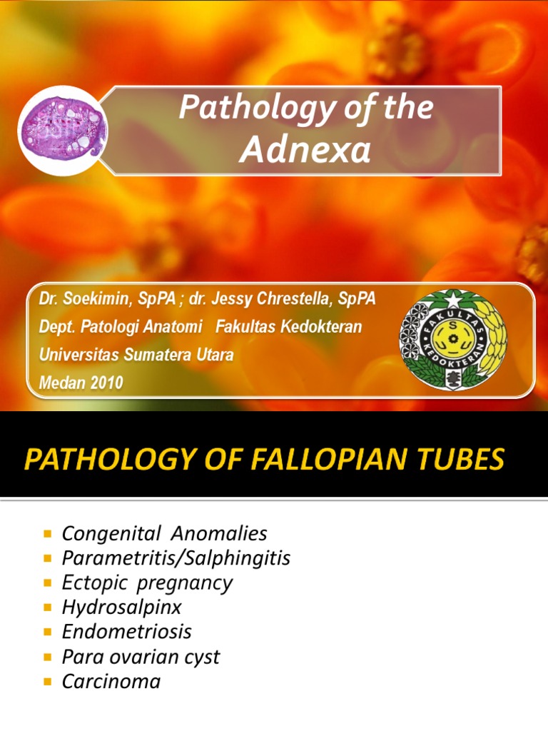 Pathology of the Adnexa | Ovarian Cancer | Neoplasms